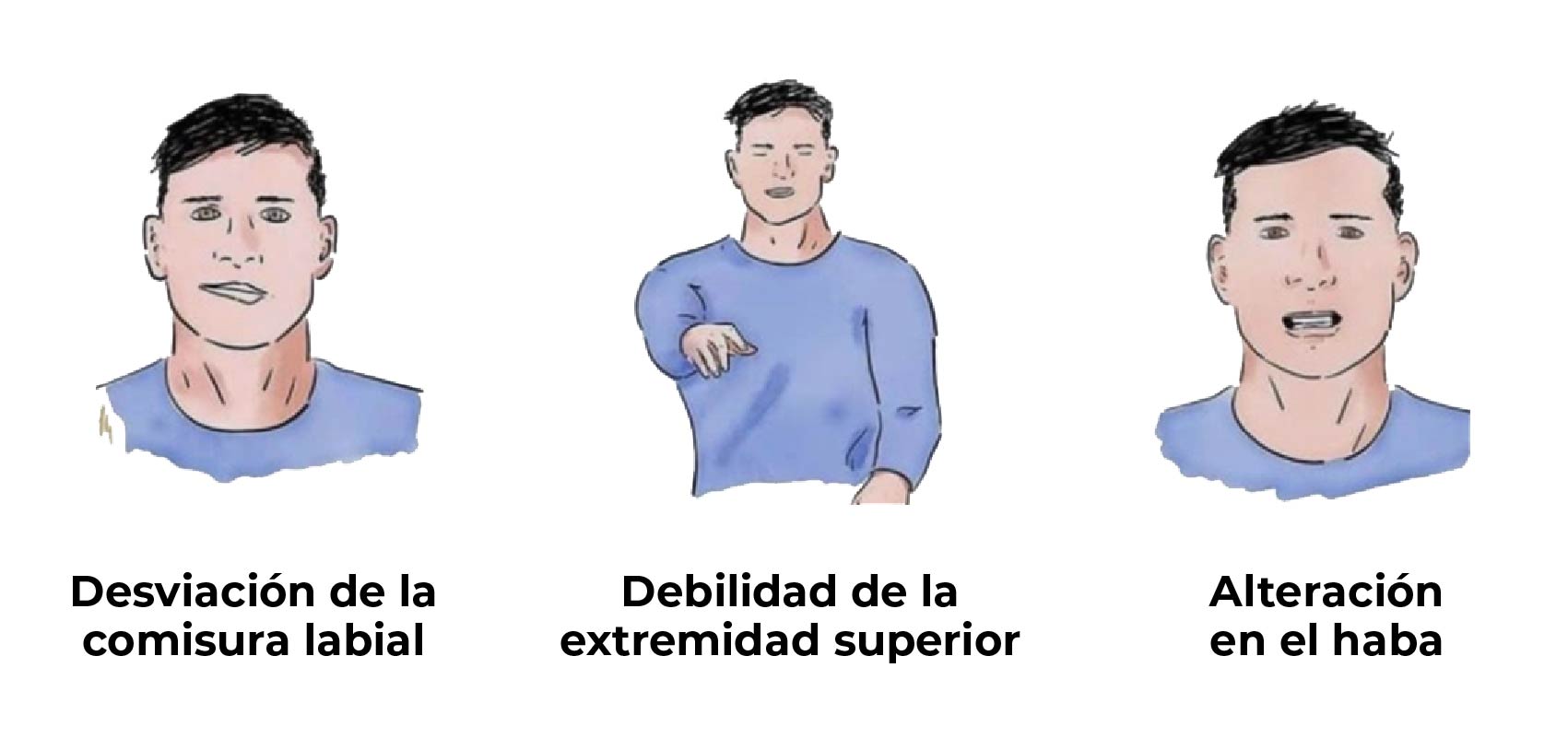 ACV: Escala de Cincinnati – SIET